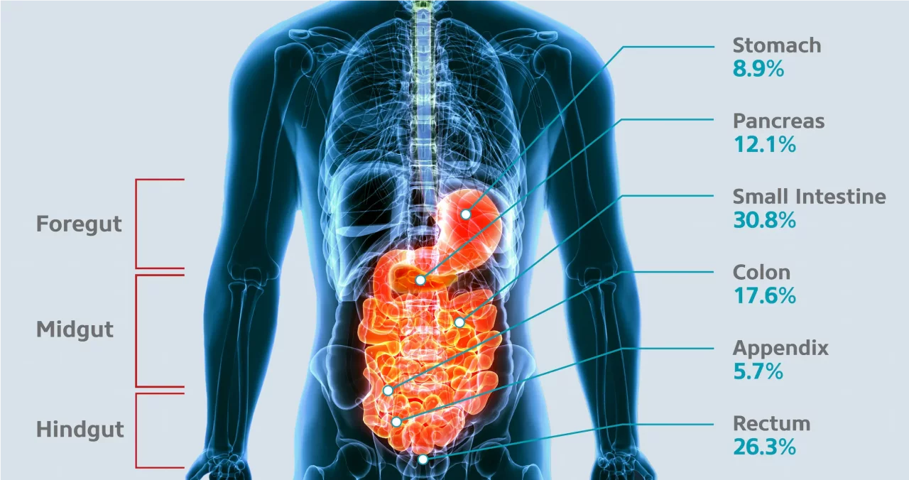 Understanding Gastroenteropancreatic Neuroendocrine Tumors (GEP-NETs)